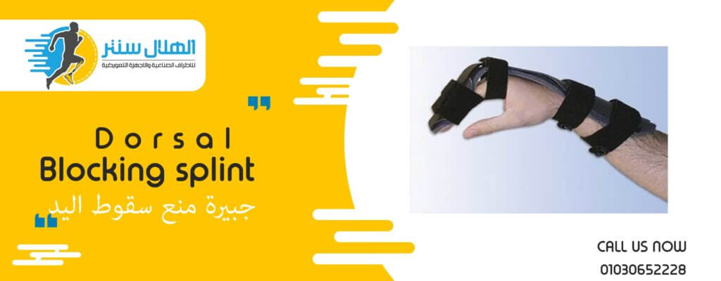 Dorsal blocking splint | الهلال سنتر للاطراف الصناعية والاجهزة التعويضية